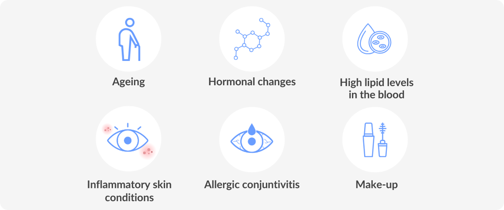 What is Meibomian Gland Dysfunction? Key Symptoms, Causes and ...