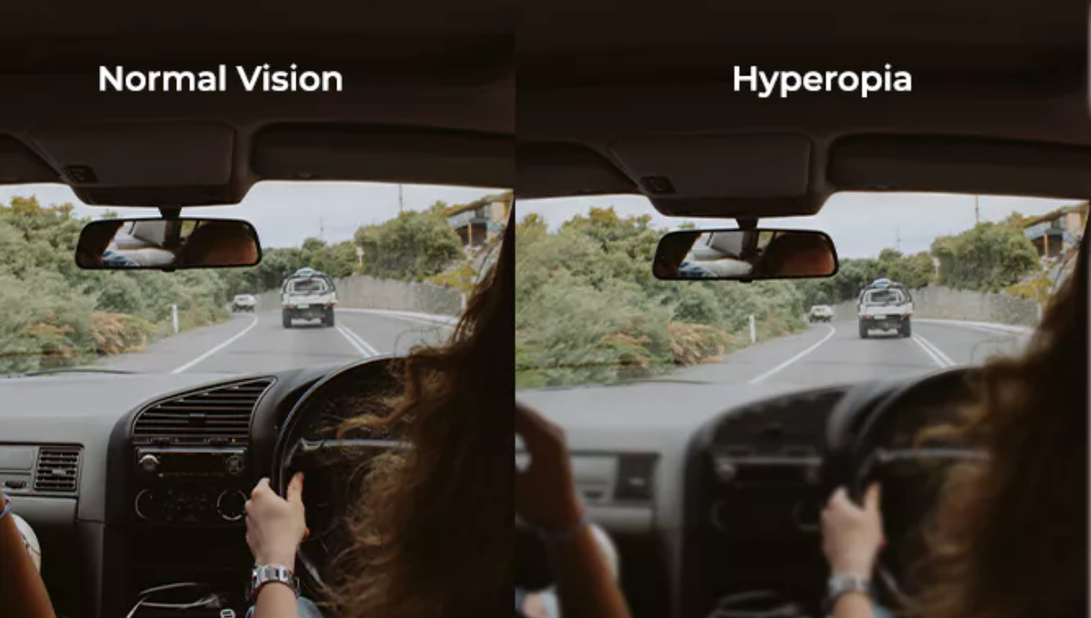 What is hyperopia | SmartBuyGlasses UK