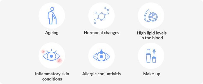 What is Meibomian Gland Dysfunction? Key Symptoms, Causes and ...