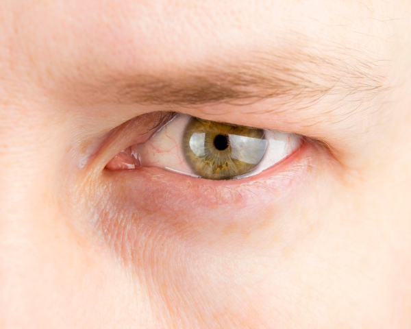Understanding Hooded Eyes | SmartBuyGlasses UK
