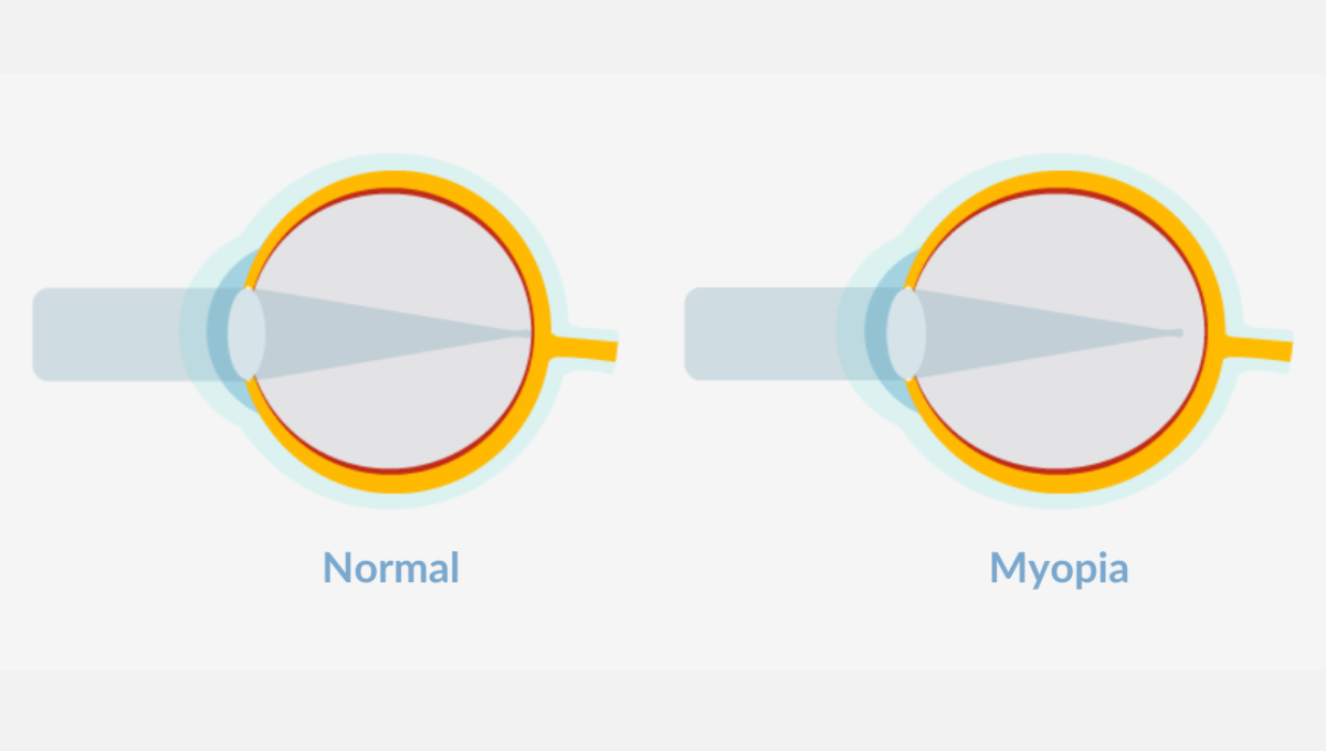 Nearsighted Glasses | SmartBuyGlasses ZA