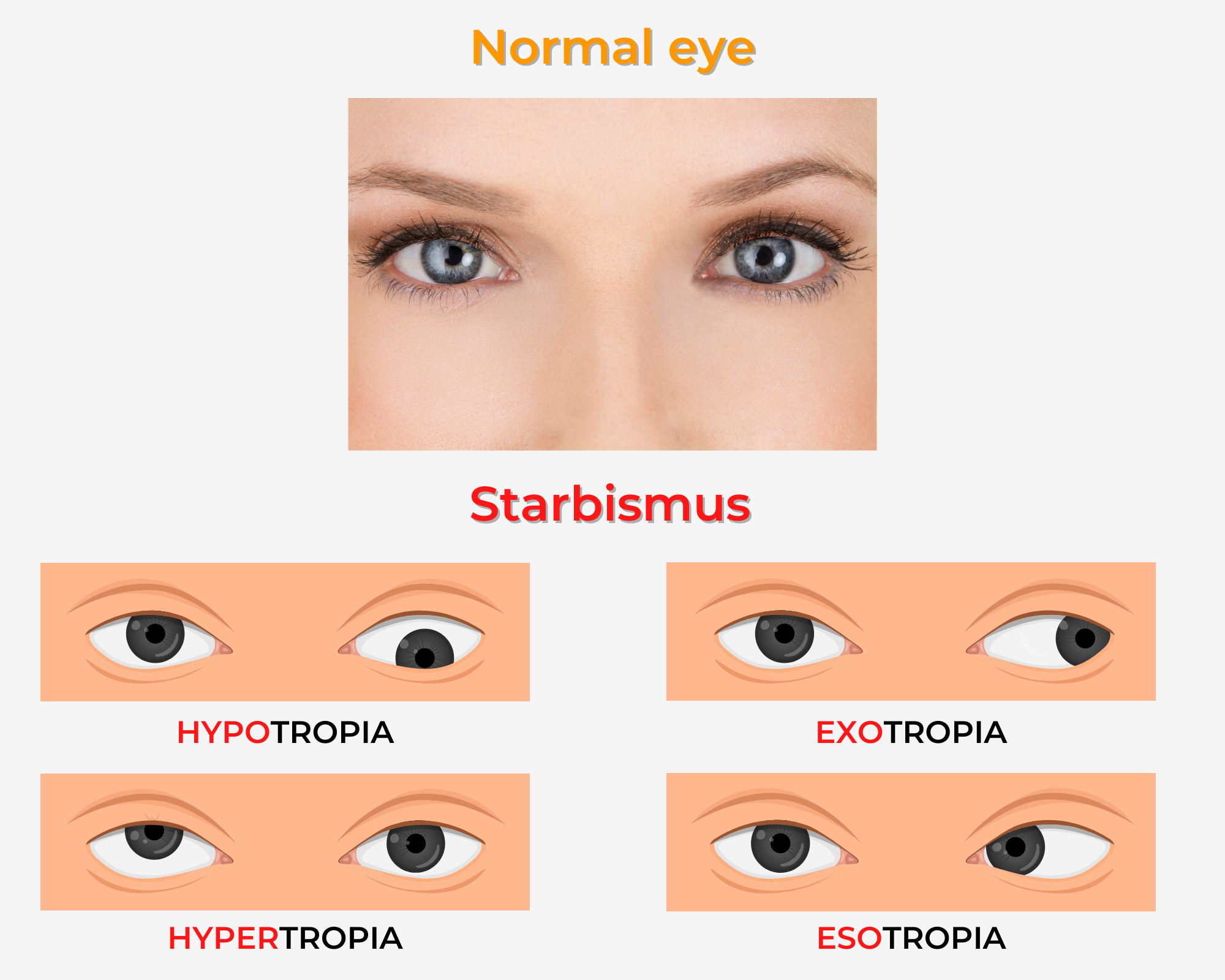 What are prism glasses | SmartBuyGlasses USA