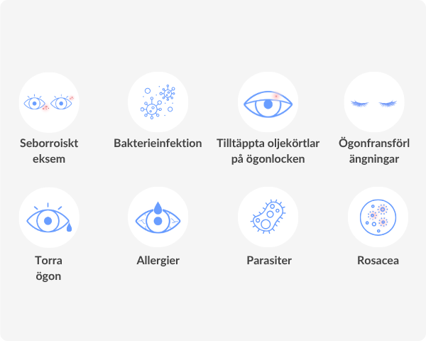 Blefarit: symtom, orsaker och möjliga behandlingar | SmartBuyGlasses SE