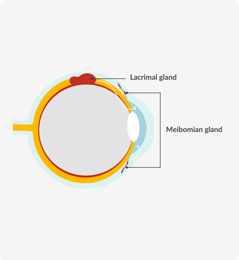 What is Meibomian Gland Dysfunction? Key Symptoms, Causes and ...