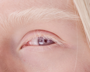 Where do Rare Eye Colours Come From? | VisionDirect AU