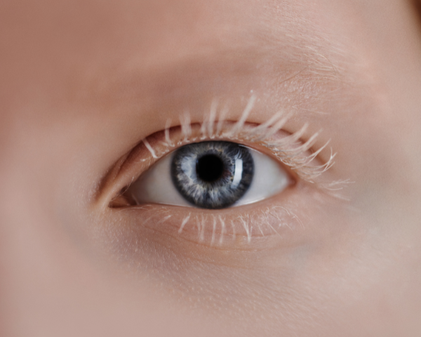Light Sensitivity to the Eyes | Vision Direct AU